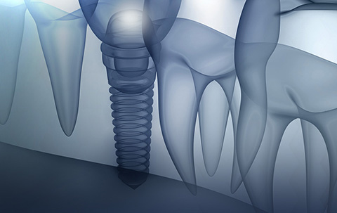 ARCH Medical Solutions | Contract manufacturing for medical OEMs