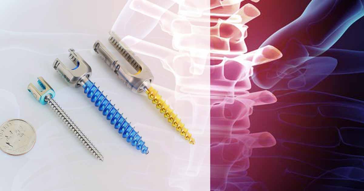 Precision manufacturing of orthopedic implants and instruments